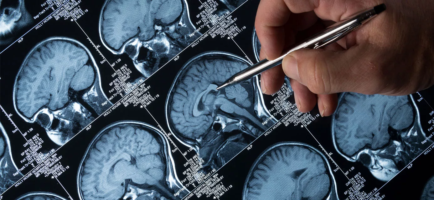 Teen Brain Development: Know the Facts | Newport Academy